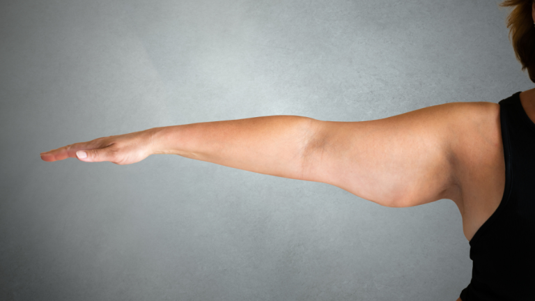 Lipoedeem: van oorzaak tot behandeling - De Huidtherapie Kliniek